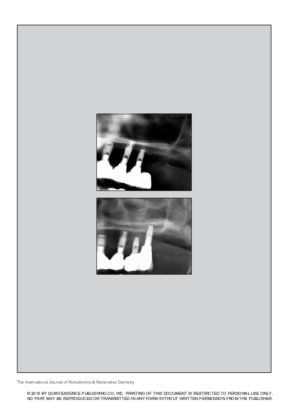 (PDF) Human Histologic and Radiographic Evidence of Bone Formation in a ...