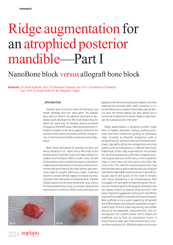 (PDF) Ridge augmentation for an atrophied posterior mandible — Part III ...