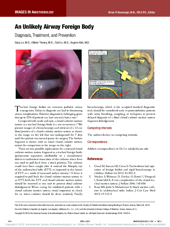 (PDF) An Unlikely Airway Foreign Body