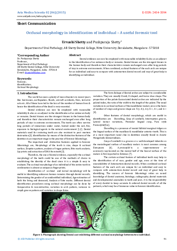 (PDF) Short Communication Occlusal morphology in identification of individual - A useful ...