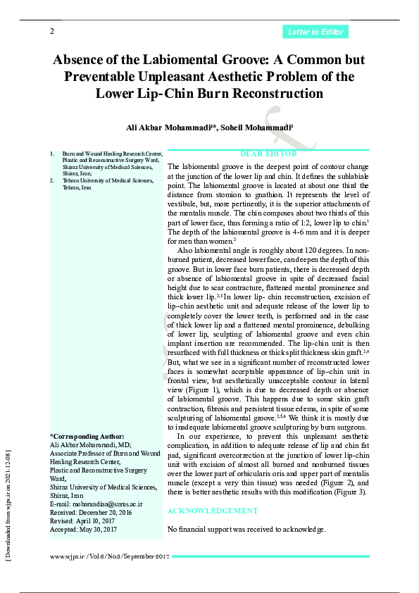 (PDF) Absence of the Labiomental Groove: A Common but Preventable ...