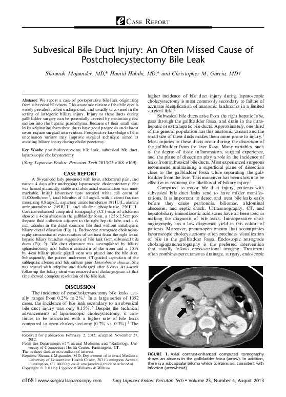 (PDF) Subvesical Bile Duct Injury | hamid habibi - Academia.edu