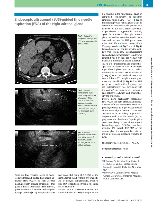 (PDF) Endoscopic Ultrasound (EUS)-guided Fine Needle Aspiration (FNA ...