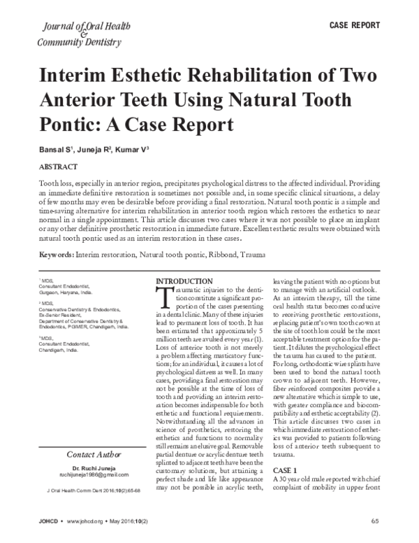 (PDF) Interim Esthetic Rehabilitation of Two Anterior Teeth Using ...