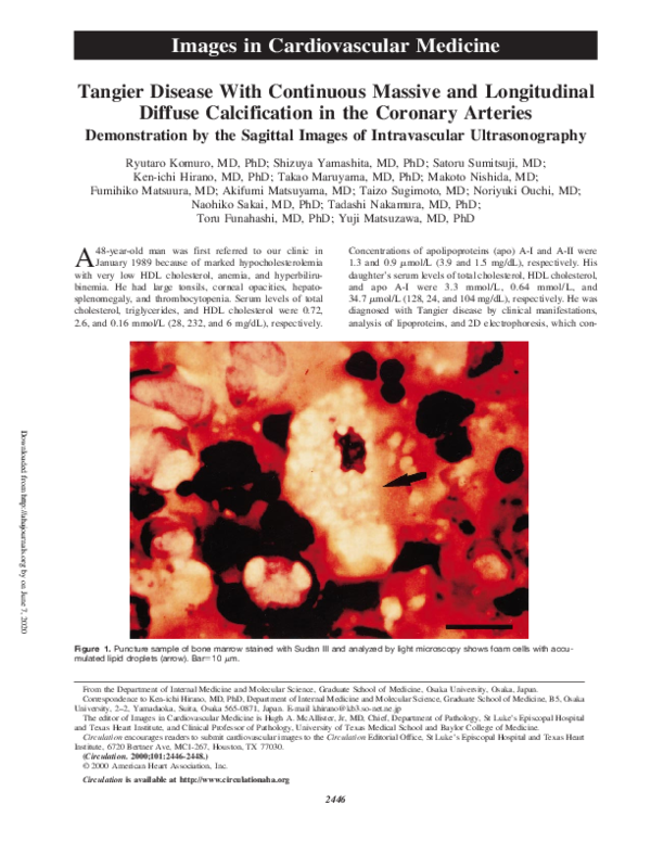 (PDF) Tangier Disease With Continuous Massive and Longitudinal Diffuse ...