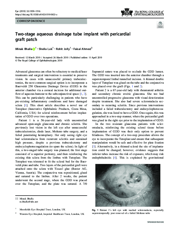 (PDF) Two-stage aqueous drainage tube implant with pericardial graft patch