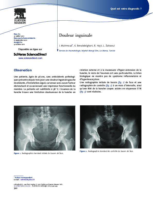 (PDF) Douleur inguinale
