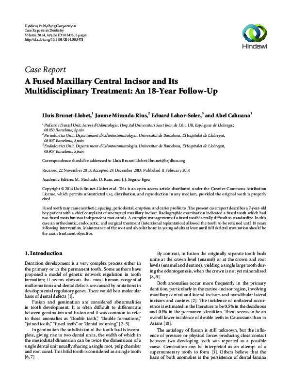 (PDF) Case Report A Fused Maxillary Central Incisor and Its