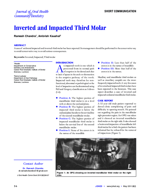 (PDF) Inverted and Impacted Third Molar