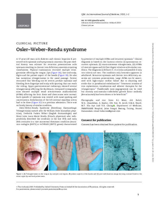 (PDF) Osler-Weber-Rendu Syndrome