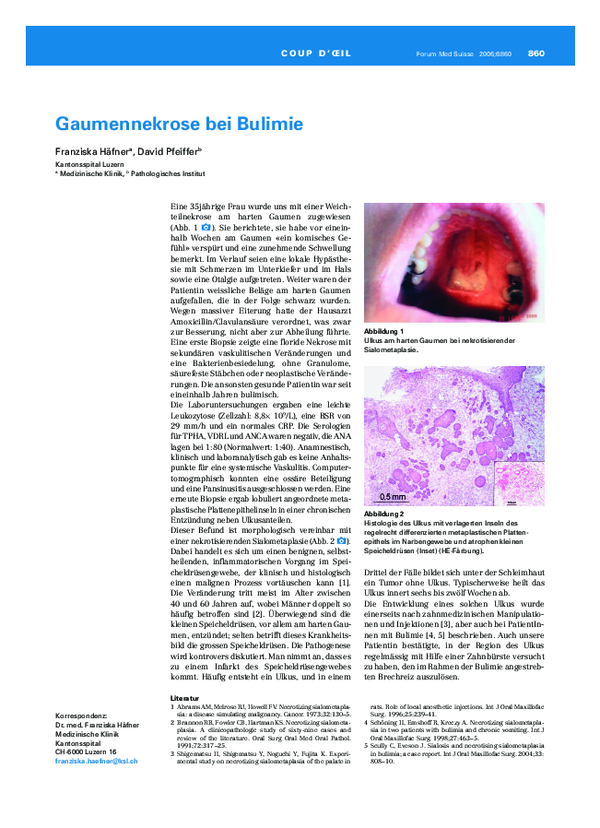 (PDF) Scully C, Eveson J. Sialosis and necrotising sialometaplasia in ...