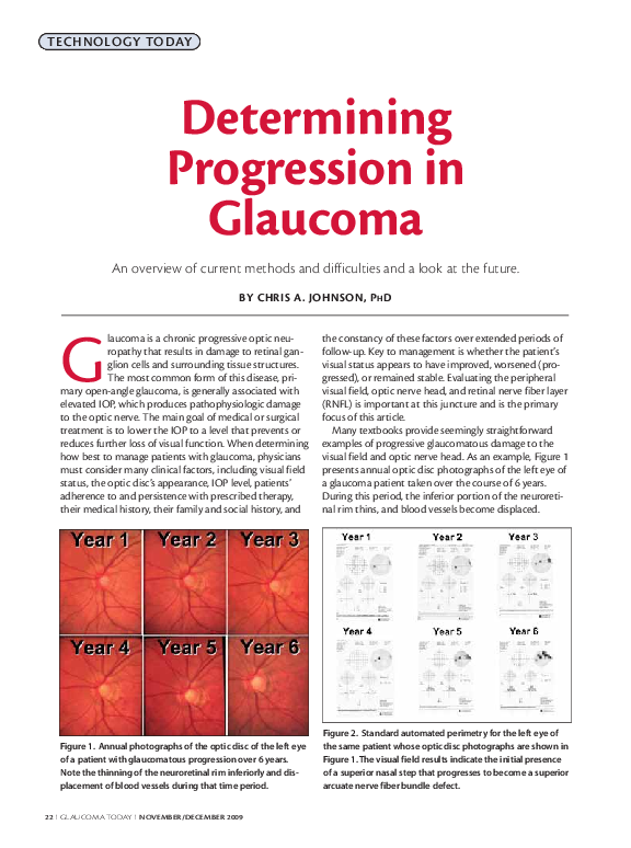 Pdf Determining Progression In Glaucoma An Overview Of Current Methods And Difficulties And A