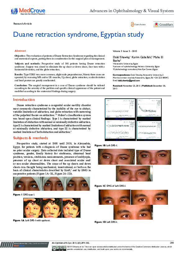 (PDF) Duane Retraction Syndrome, Egyptian Study