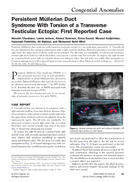(PDF) Persistent Müllerian Duct Syndrome With Torsion of a Transverse ...