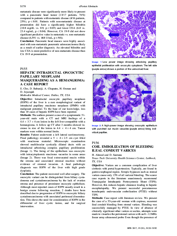 (PDF) Coil embolization of bleeding ileal conduit varices