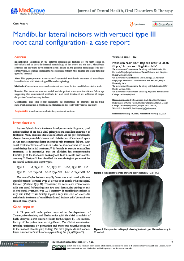 (PDF) Mandibular lateral incisors with vertucci type III root canal ...