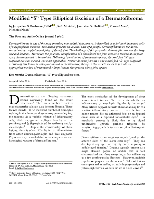 (PDF) Modified “S” Type Elliptical Excision of a Dermatofibroma