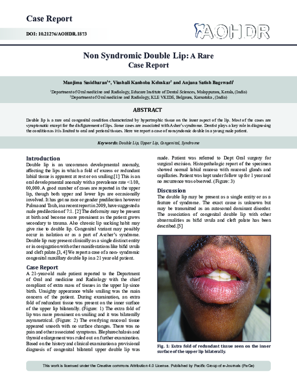 (PDF) Non syndromic double lip- a rare case report