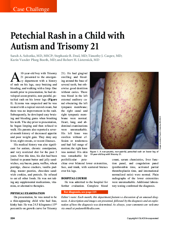 (PDF) Petechial Rash in a Child with Autism and Trisomy 21 | Stephanie ...