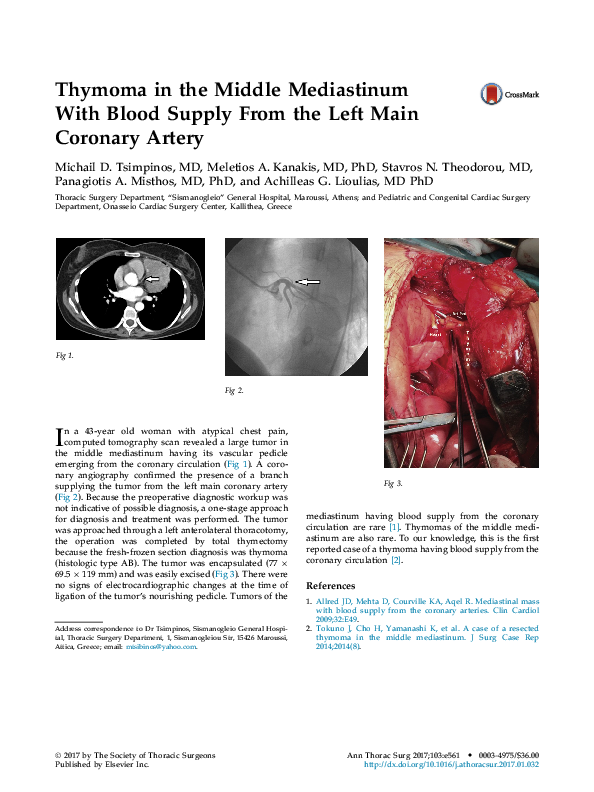 (PDF) Thymoma in the Middle Mediastinum With Blood Supply From the Left Main Coronary Artery