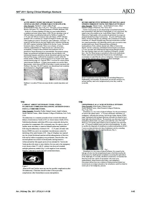 (PDF) 116 Urinothorax as a Cause of Pleural Effusion | Pamela Santos ...