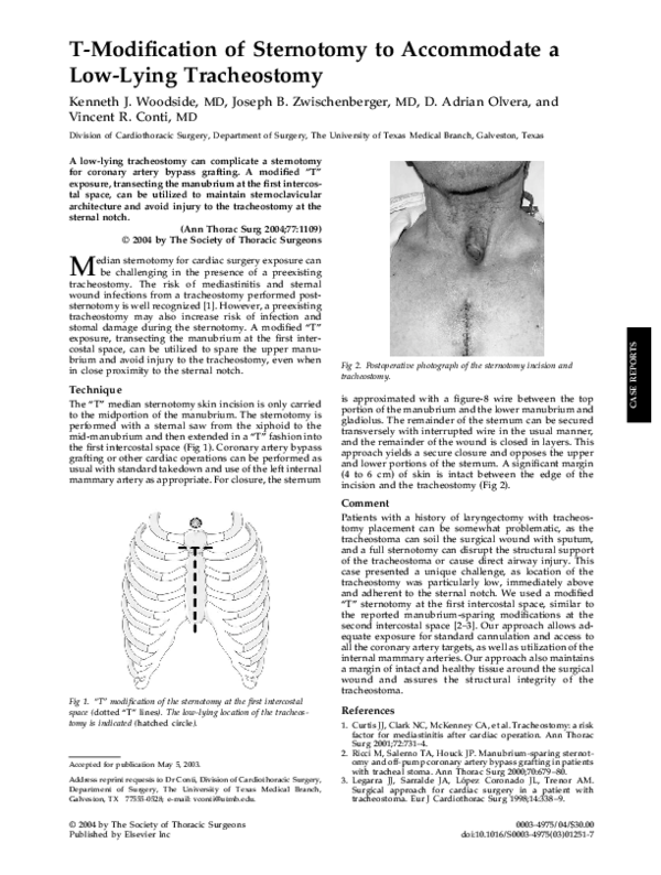 (PDF) T-modification of sternotomy to accommodate a low-lying tracheostomy