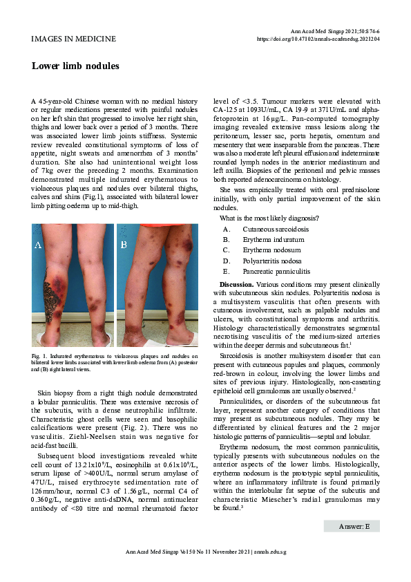 (PDF) Lower limb nodules