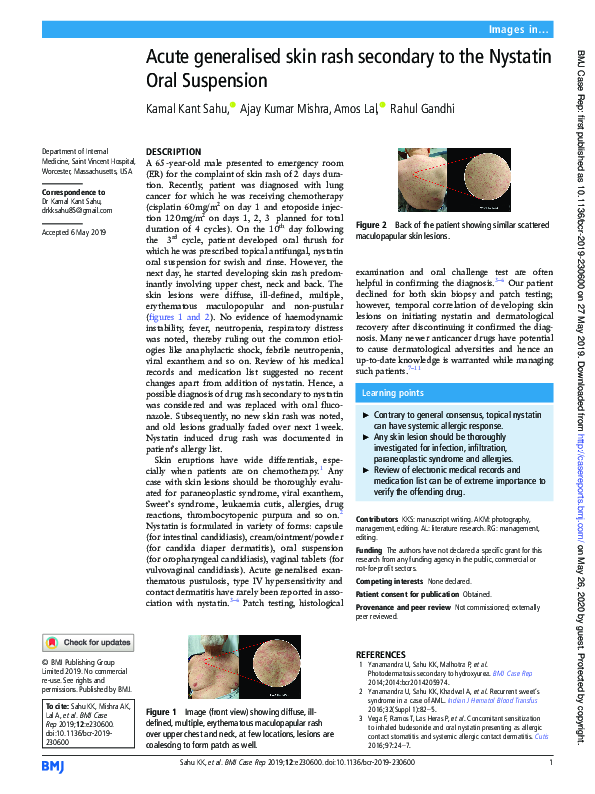 (PDF) Acute generalised skin rash secondary to the Nystatin Oral Suspension