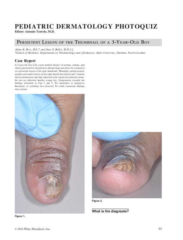 (PDF) Pediatric Dermatology Photoquiz: Persistent Lesion of the ...