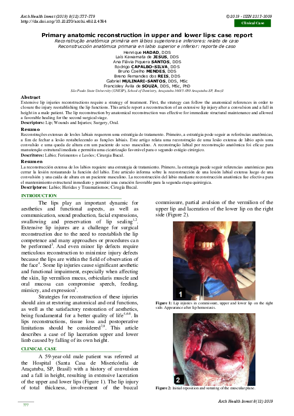 (PDF) Primary anatomic reconstruction in upper and lower lips: case report