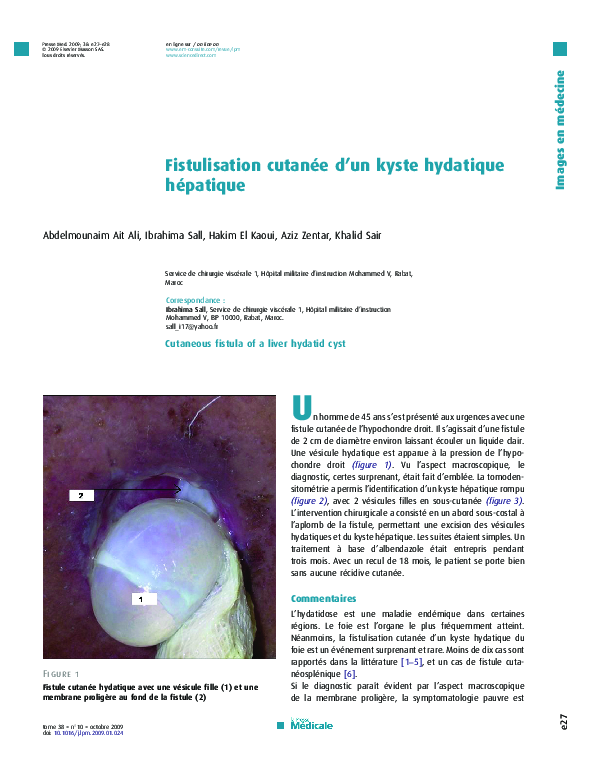 (PDF) Fistulisation cutanée d’un kyste hydatique hépatique