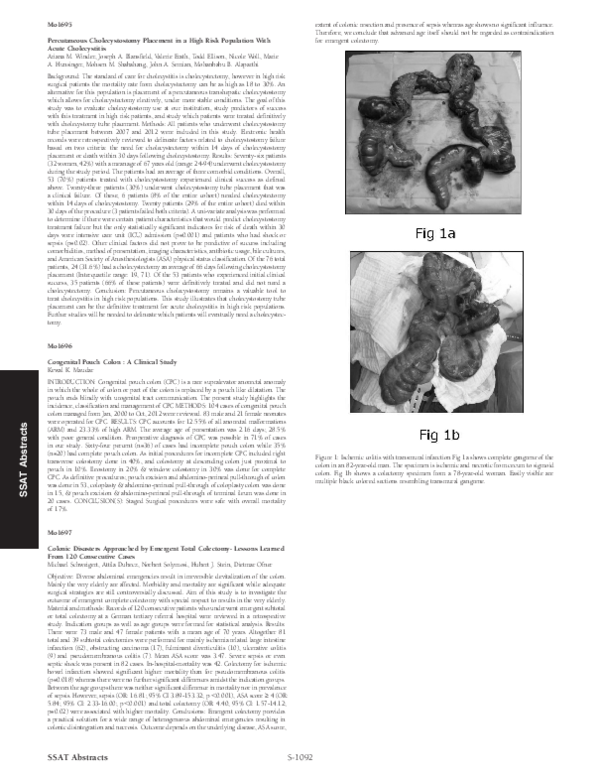 (PDF) Mo1695 Percutaneous Cholecystostomy Placement in a High Risk ...
