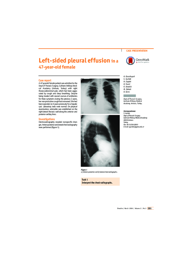 (PDF) Left-sided pleural effusion in a 47-year-old female