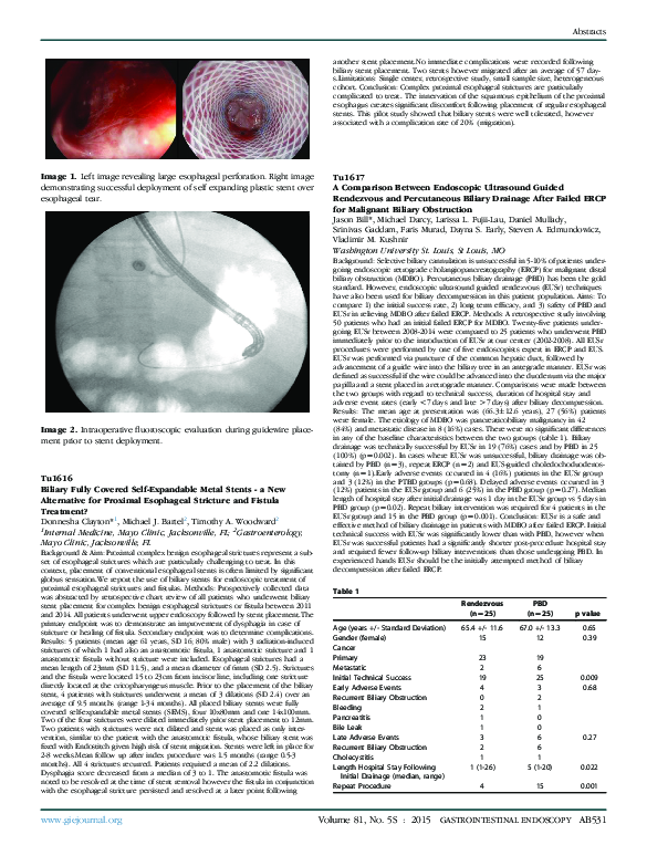 (PDF) Tu1617 A Comparison Between Endoscopic Ultrasound Guided ...