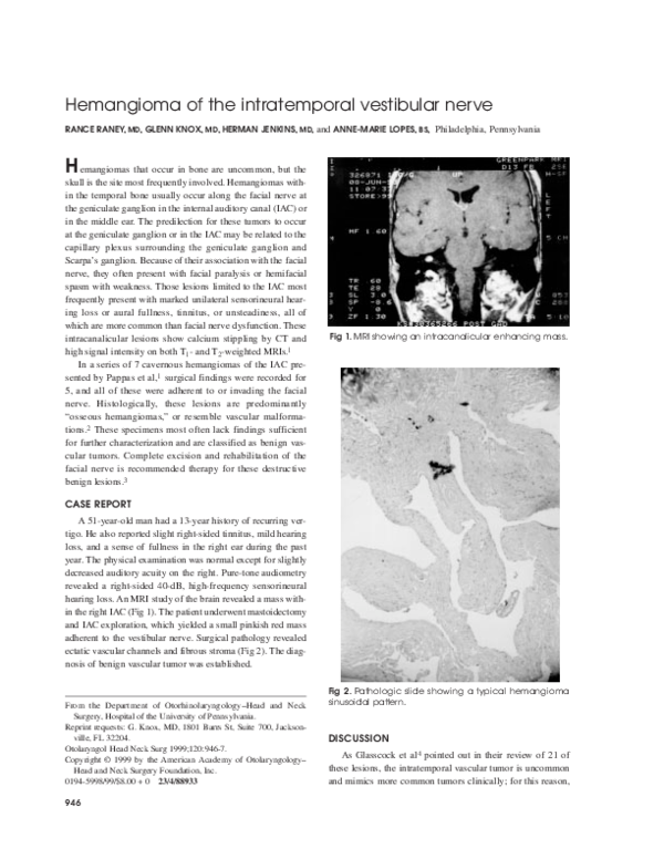 (PDF) Hemangioma of the Intratemporal Vestibular Nerve