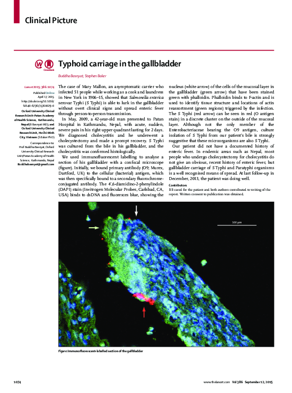 (PDF) Typhoid carriage in the gallbladder