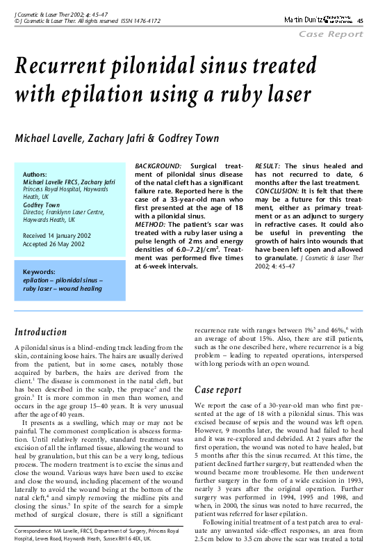 (PDF) Recurrent pilonidal sinus treated with epilation using a ruby laser