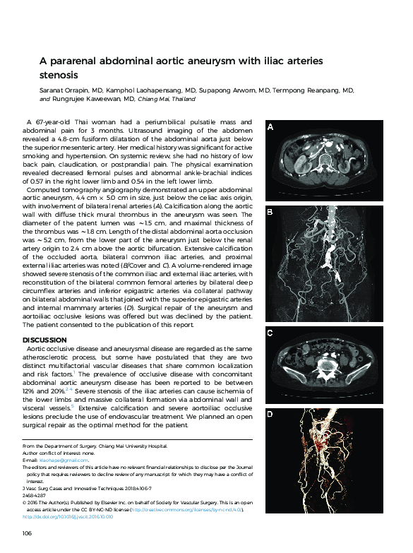(PDF) A pararenal abdominal aortic aneurysm with iliac arteries stenosis