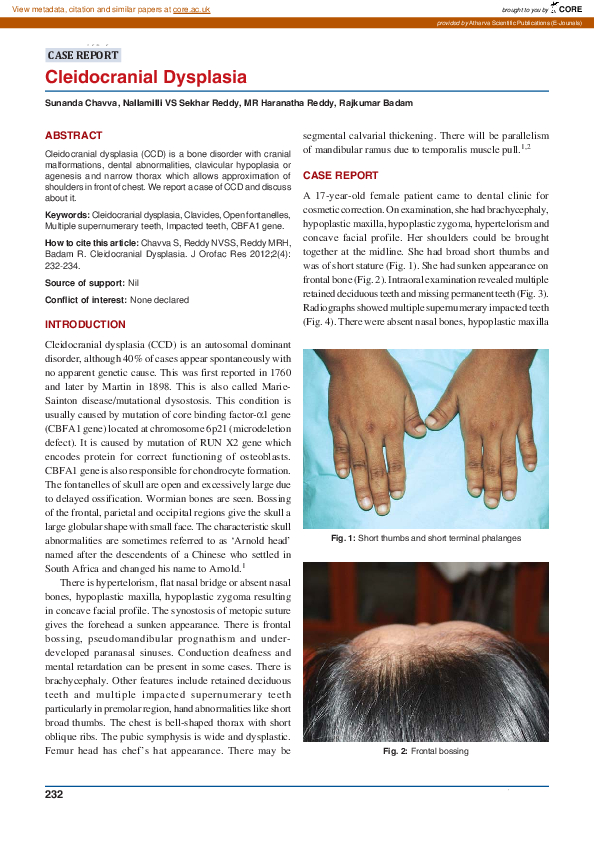 (PDF) Cleidocranial Dysplasia