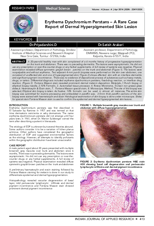 (PDF) Erythema Dyschromium Perstans – A Rare Case Report of Dermal ...