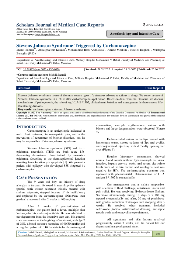 (PDF) Stevens Johnson Syndrome Triggered by Carbamazepine