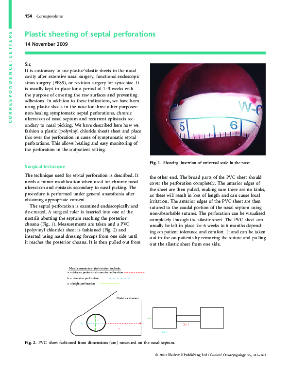 (PDF) Plastic sheeting of septal perforations | mohammed syed ...