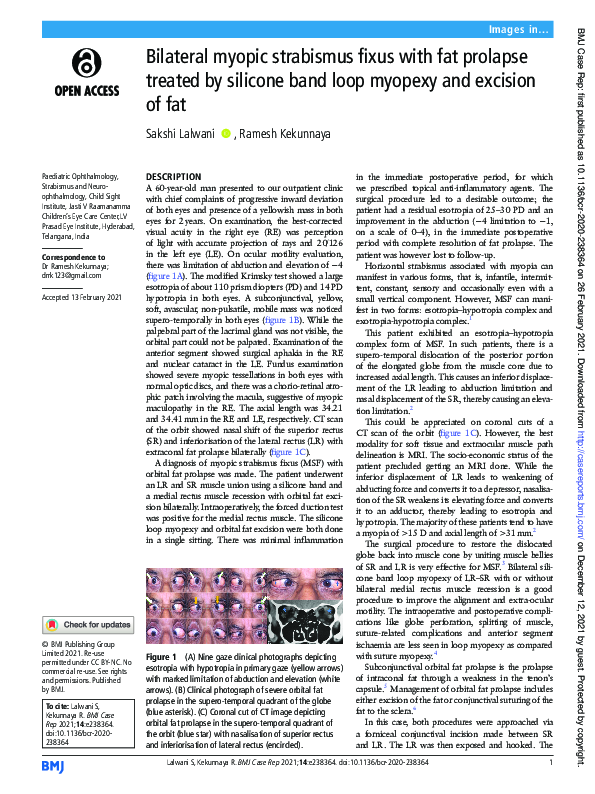 (PDF) Bilateral myopic strabismus fixus with fat prolapse treated by ...