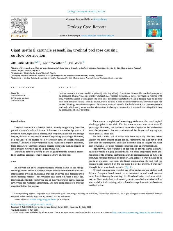 (PDF) Giant urethral caruncle resembling urethral prolapse causing ...
