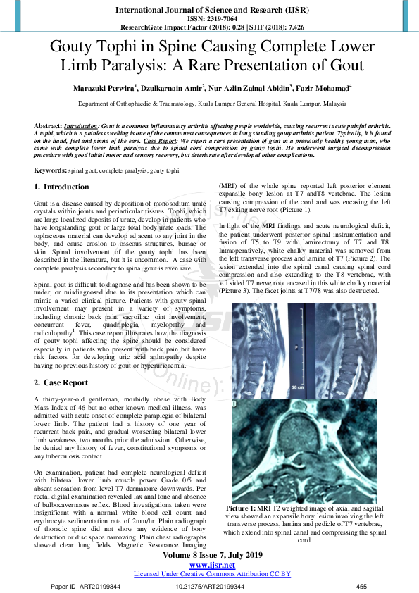 (PDF) Gouty Tophi in Spine Causing Complete Lower Limb Paralysis : A ...
