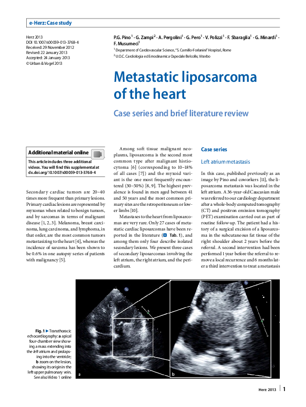 (PDF) Metastatic liposarcoma of the heart