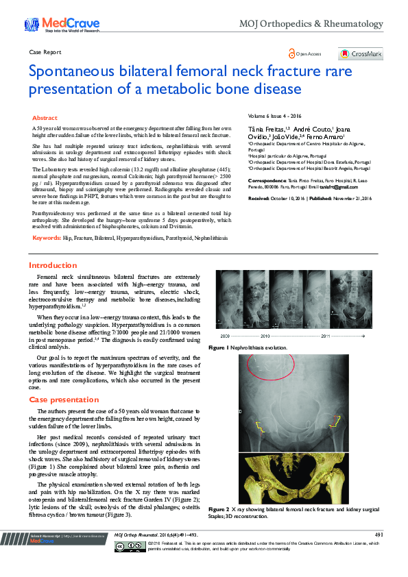 (PDF) Spontaneous Bilateral Femoral Neck Fracture Rare Presentation of ...