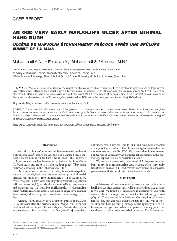 (PDF) An odd very early marjolin's ulcer after minimal hand burn | ali ...