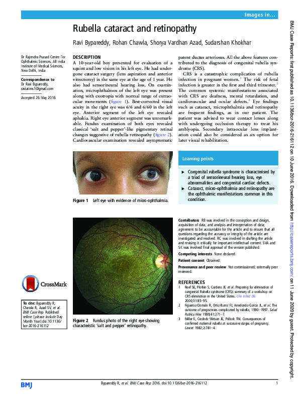 (PDF) Rubella cataract and retinopathy