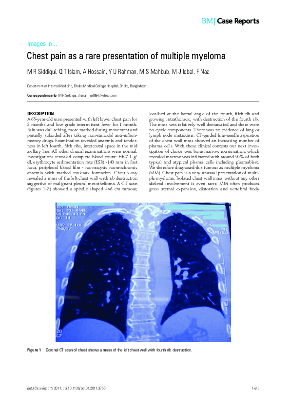(PDF) Chest pain as a rare presentation of multiple myeloma